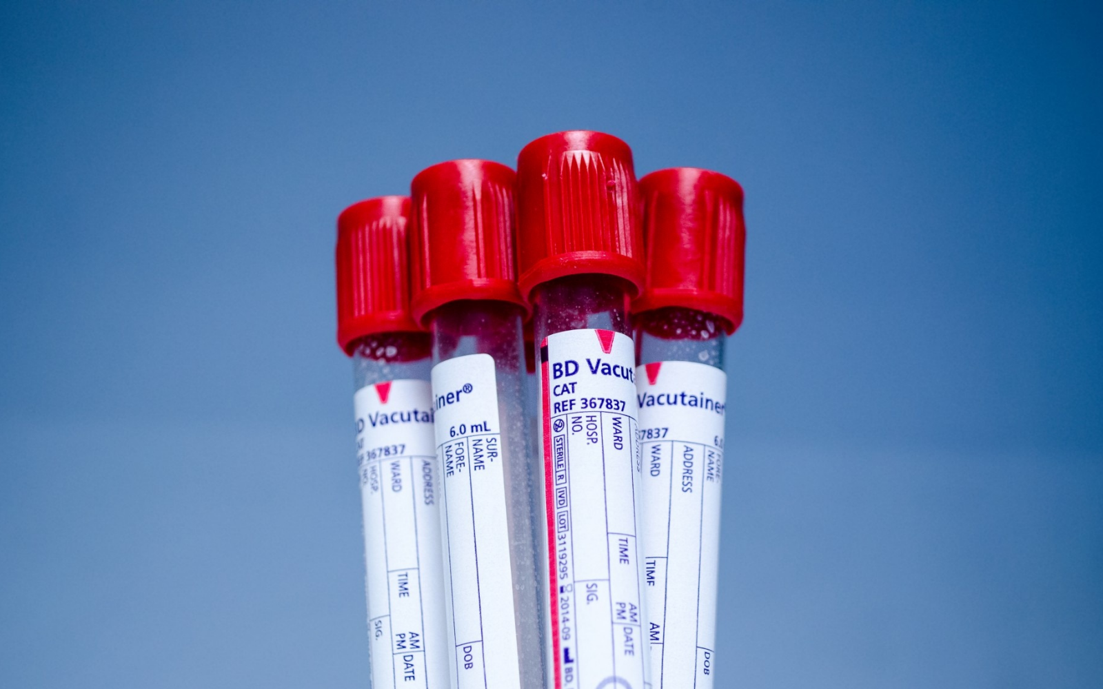 Tackling transfusion with a universal blood type - Canadian Light Source